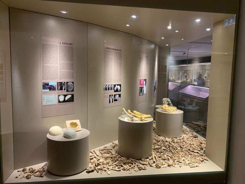 Musa Milano: arriva il museo su delitti, autopsie e resti umani
